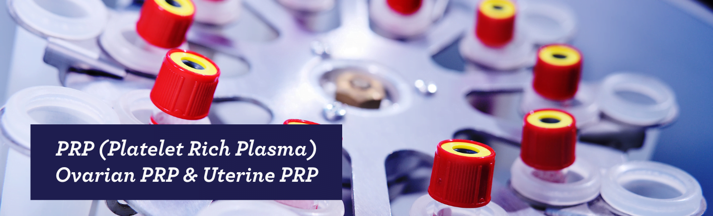PRP (Platelet Rich Plasma) Ovarian PRP and Uterine PRP